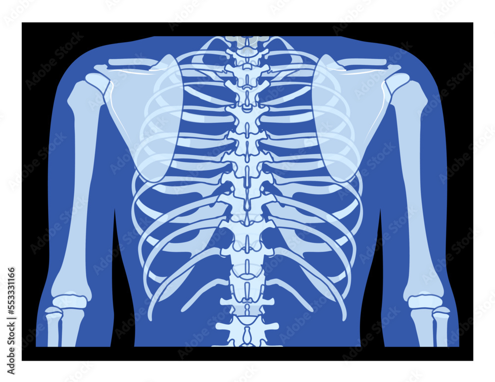 Vector de Stock X-Ray rib cage and hands Skeleton Human body Bones ...
