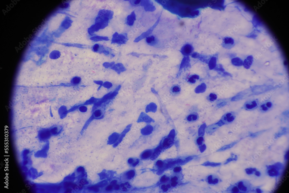 Mycobacterium tuberculosis appearance under the microscope is red with ...