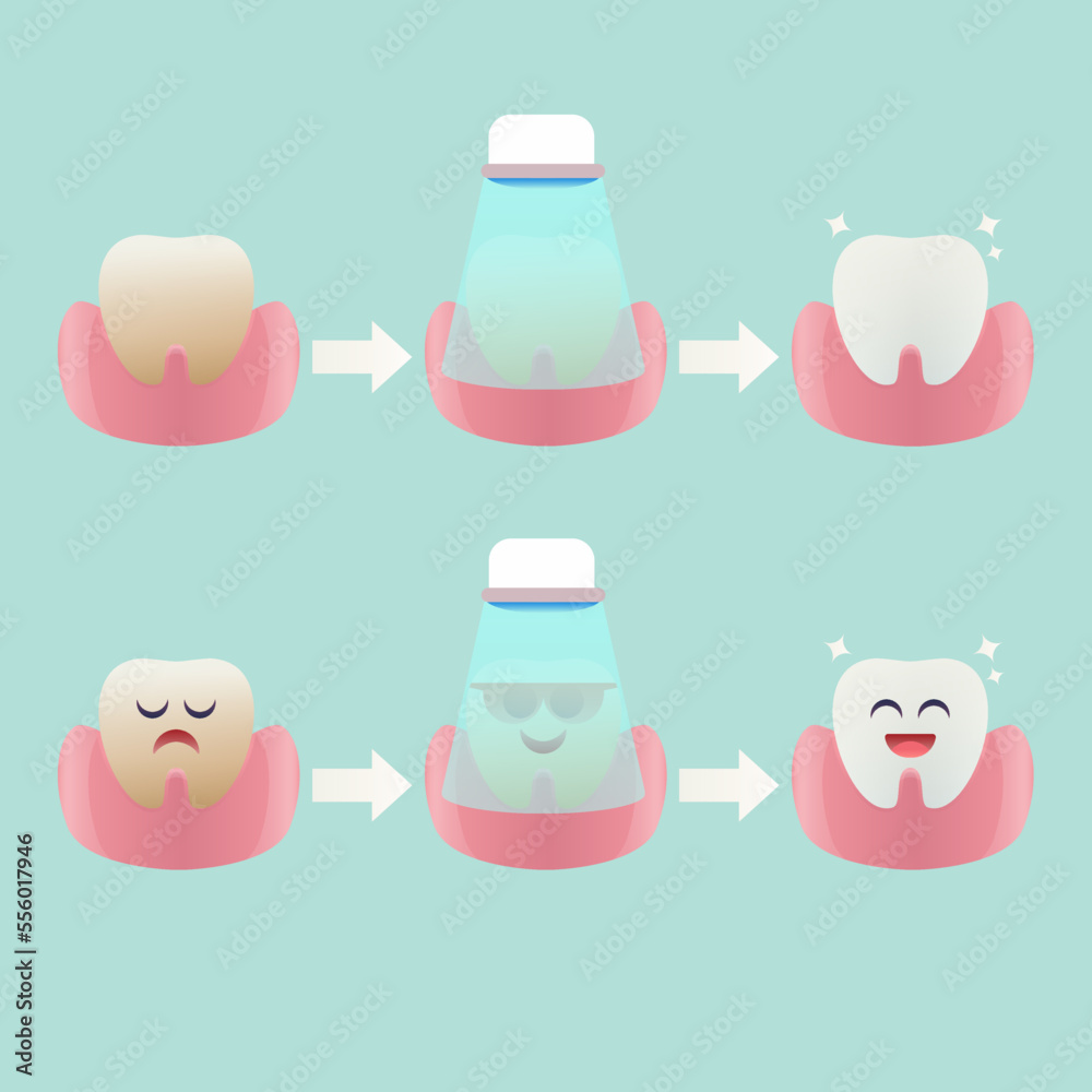 Cute cartoon teeth characters before and after whitening process. Flat ...