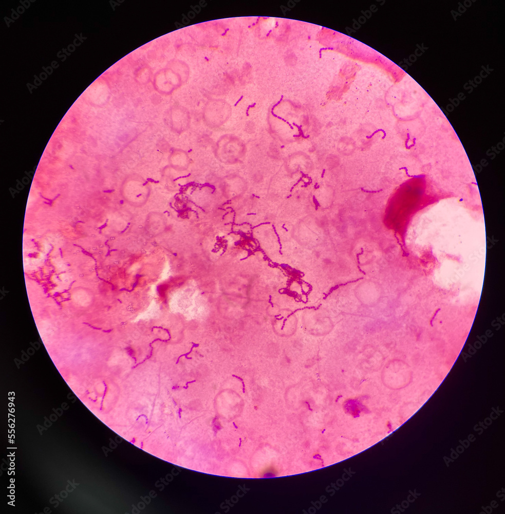 Gram positive cocci in chains. Stock Photo | Adobe Stock