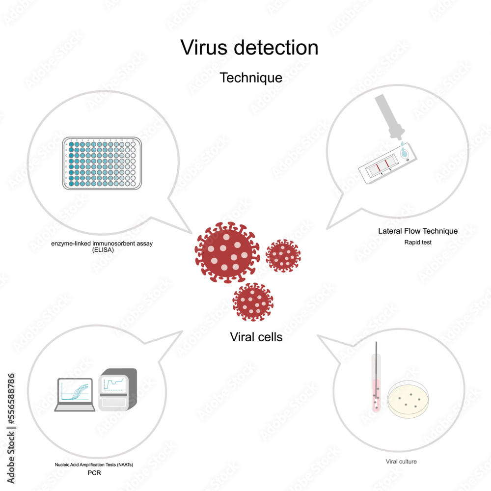 The viral detection technique that picture represent in 4 icons of ...