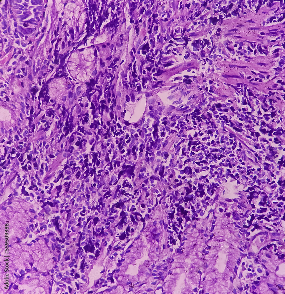 Light micrograph of wall of the small intestine (duodenum) showing ...