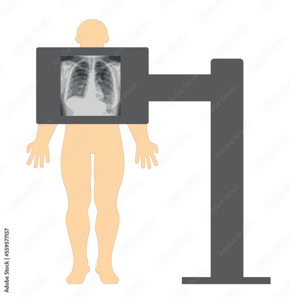 Chest x-ray illustration. Man standard by in x-ray machine Stock Vector ... Chest x-ray illustration. Man standard by in x-ray machine Stock Vector ...