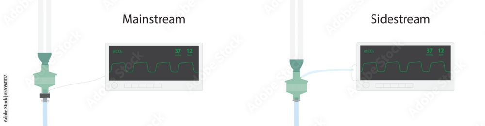 Different types of capnography measurement. Mainstream versus ...