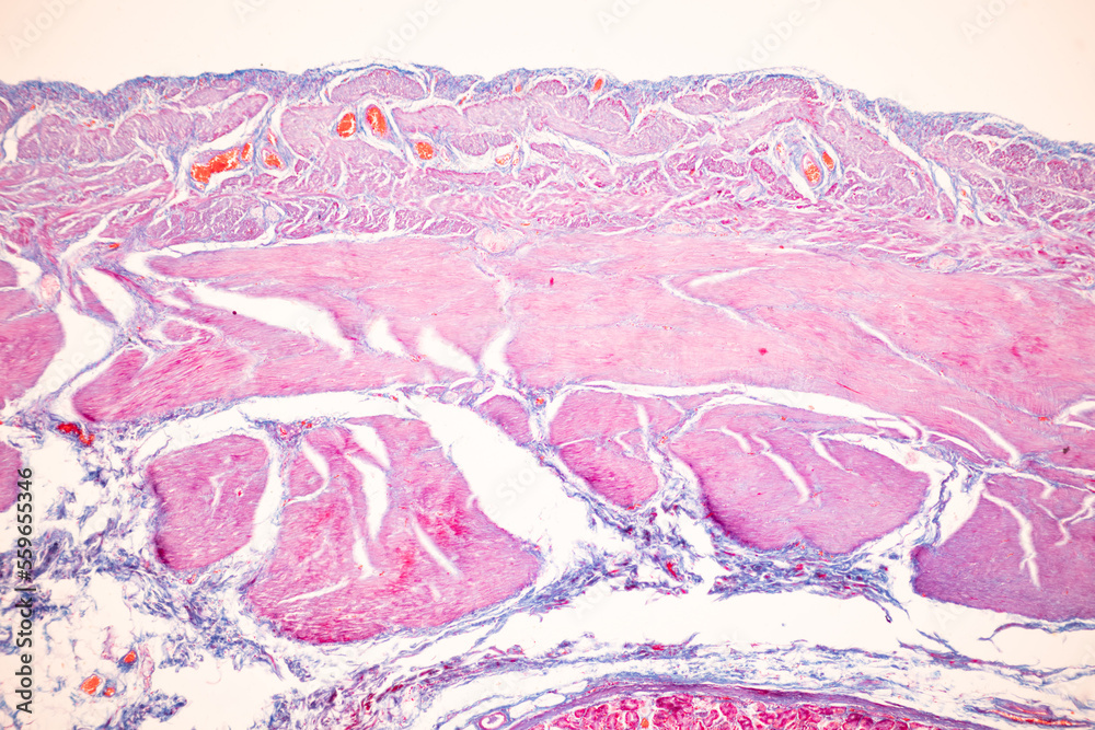 ภาพถ่าย Stock Tissue of Small intestine (Duodenum), Large intestine ...