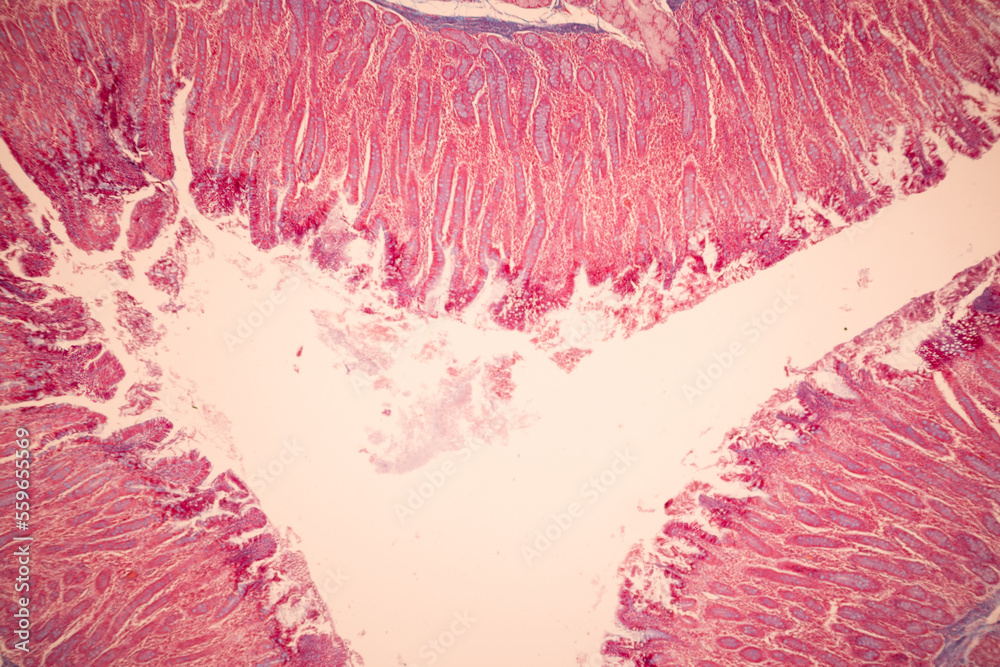 Tissue of Small intestine (Duodenum), Large intestine Human and Stomach ...