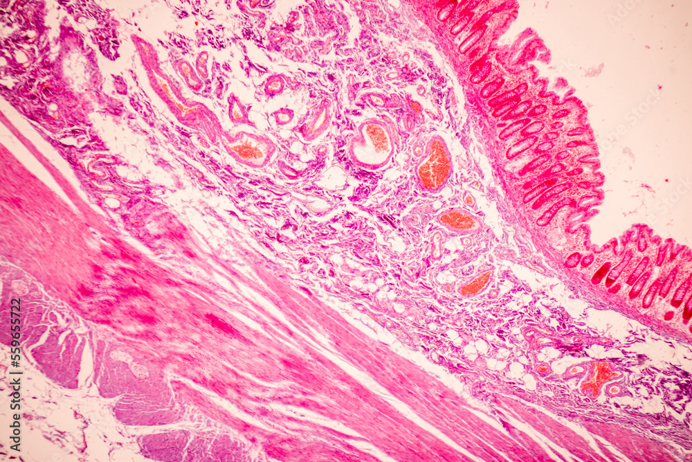 Tissue of Small intestine (Duodenum), Large intestine Human and Stomach ...