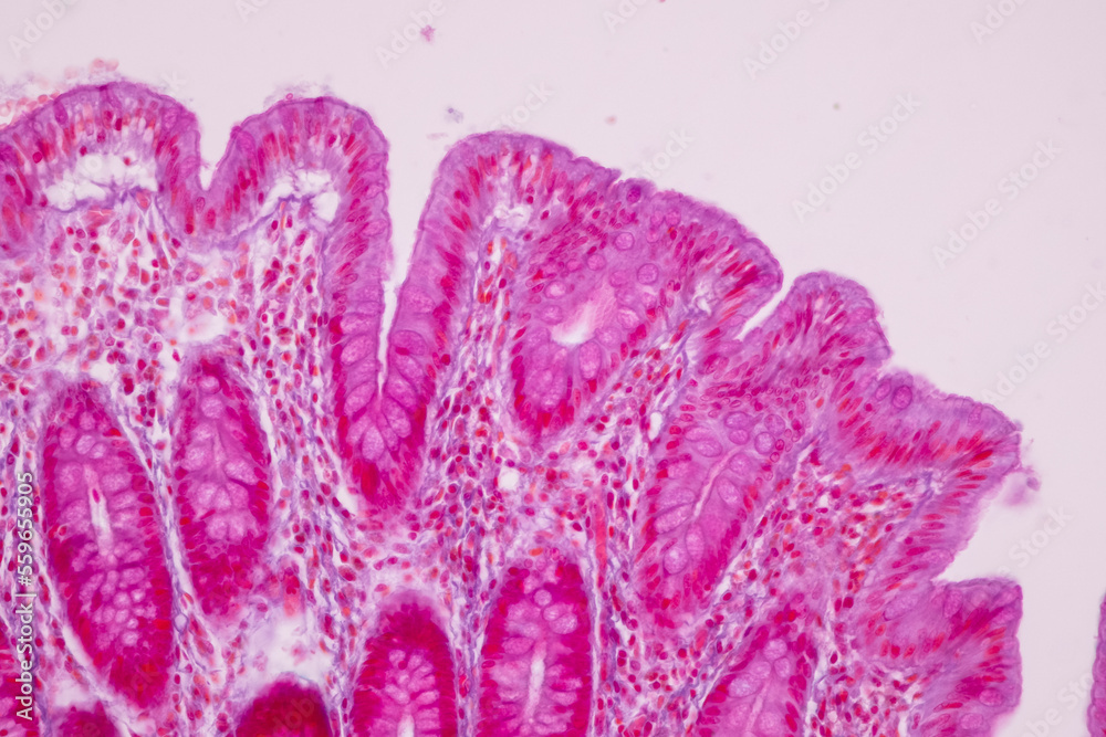 Tissue of Small intestine (Duodenum), Large intestine Human and Stomach ...