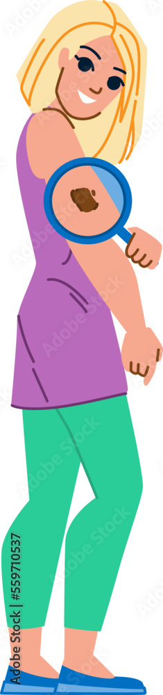 skin cancer vector. melanoma patient, medicine doctor, health woman ...
