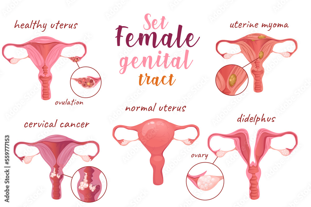 Female genatal tract 3d realistic set. Bundle of uterus anatomy at ...