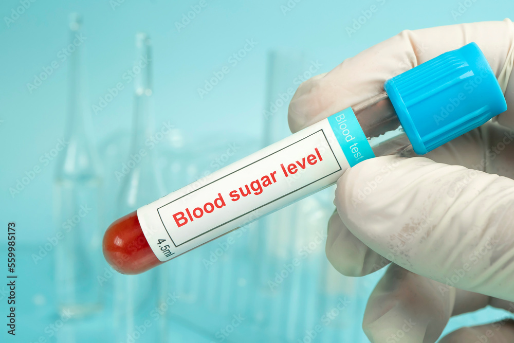 Foto Medical concept. Laboratory sample tube of glycated hemoglobin or ...
