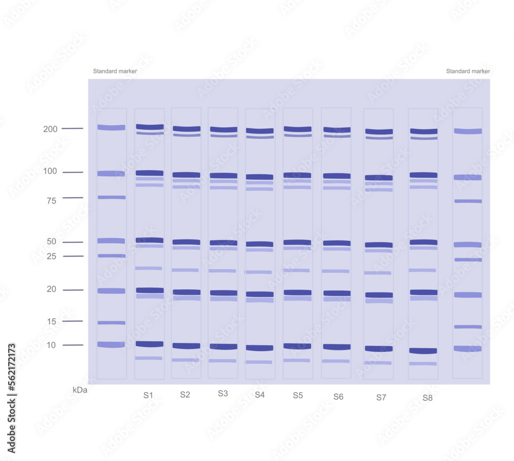 The SDS-PAGE (sodium dodecyl sulfate-polyacrylamide gel electrophoresis ...