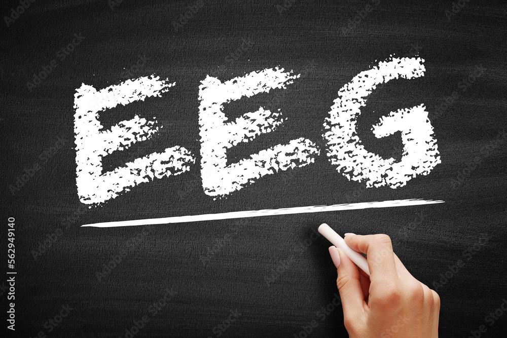 EEG Electroencephalogram - test that records the electrical signals of ...