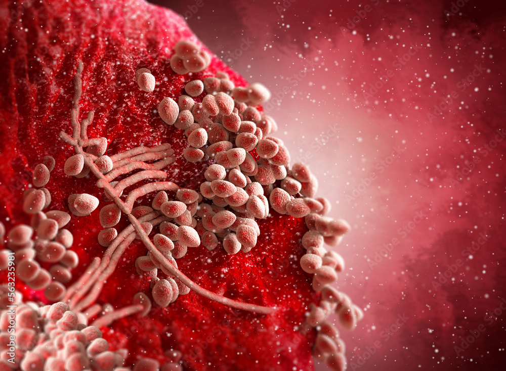 Medical background, Staphylococcus aureus, a type of spherical gram ...