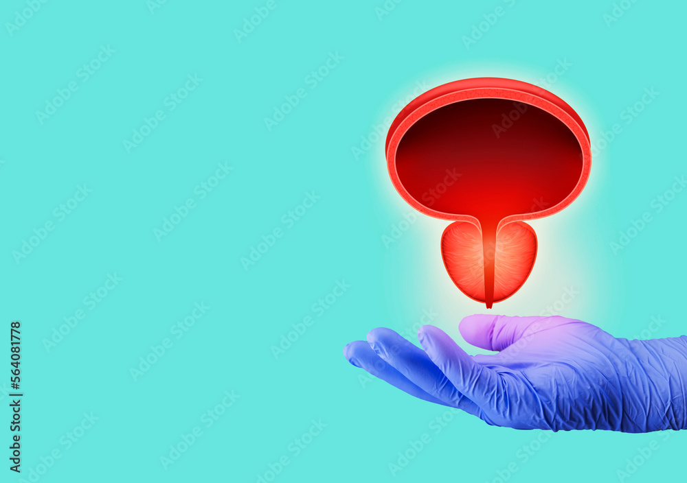 Bladder and prostate gland in the hand of physician, HPB. Prostate ...