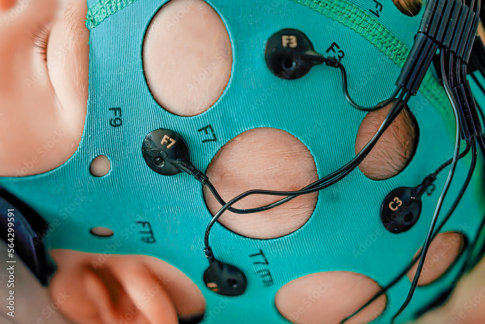 Fotografie A sleep child EEG is a recording. Electrical activity of the ...