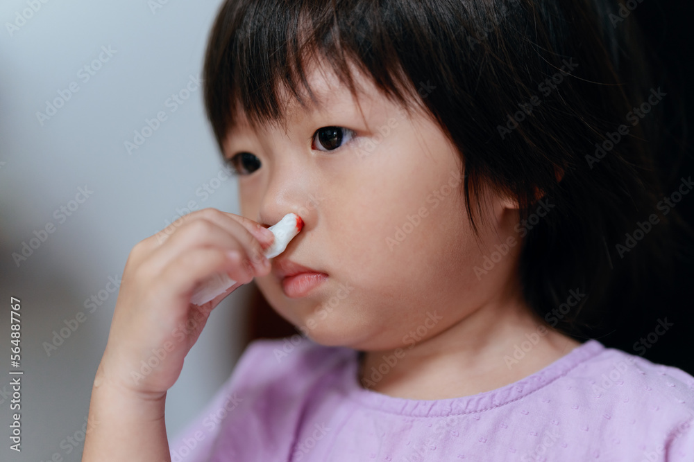 Child uses tissue to stop nosebleed Stock Photo | Adobe Stock