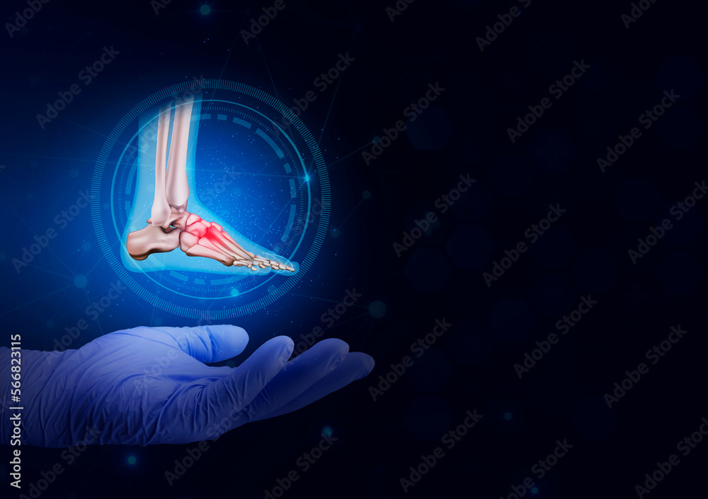 Photo Stock Foot pain, upper part, inflammation, arthritis ...