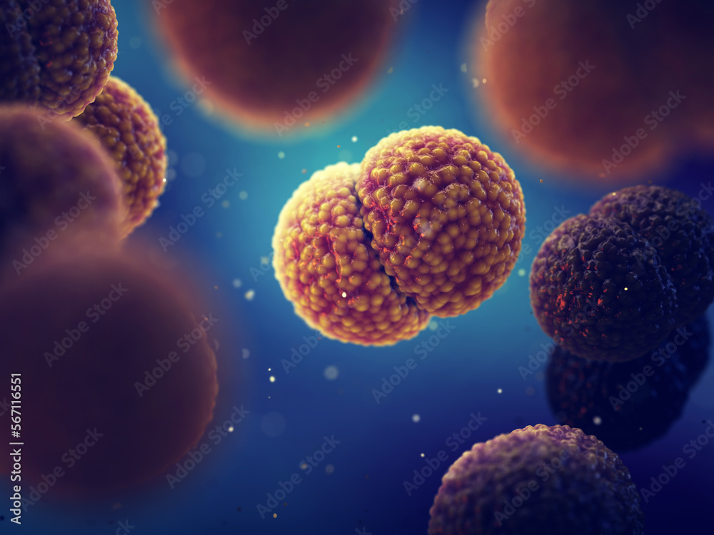 Meningitis bacteria, Neisseria meningitidis. Meningococcal meningitis ...