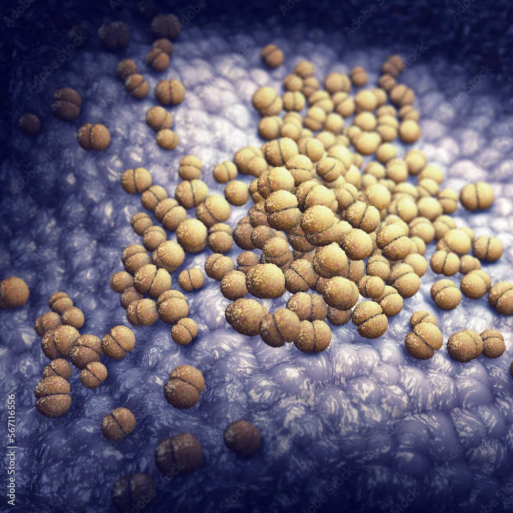 Meningitis bacteria, Neisseria meningitidis. Meningococcal meningitis ...