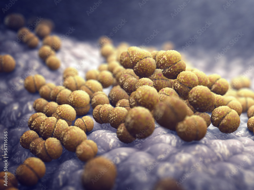 Meningitis bacteria, Neisseria meningitidis. Meningococcal meningitis ...