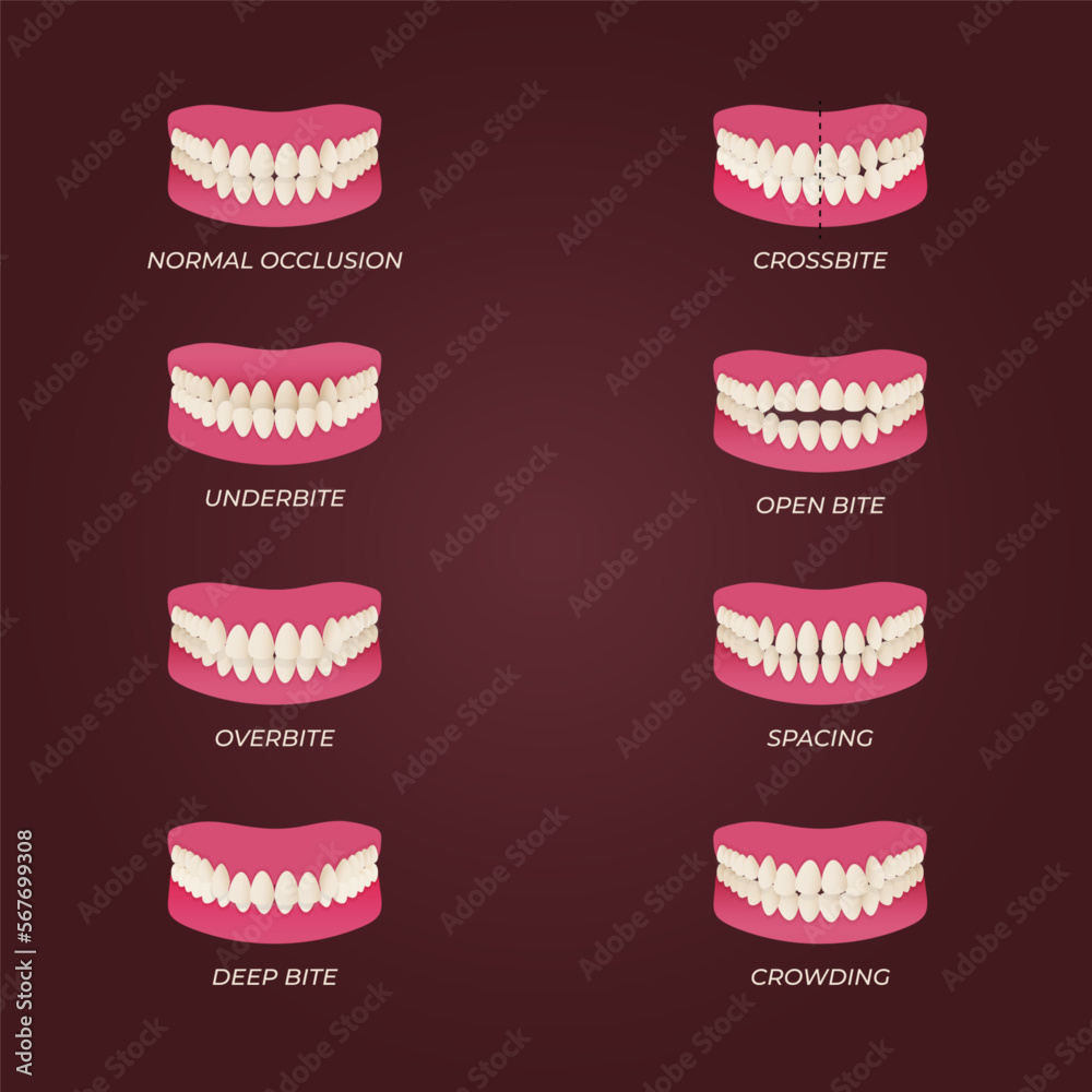 Medical dental diagram illustration. Orthodontist human tooth anatomy ...