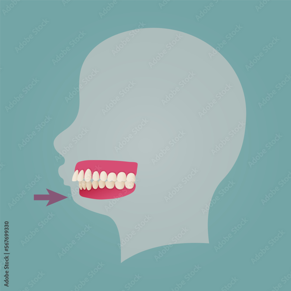 Medical dental diagram illustration. Orthodontist human tooth anatomy ...