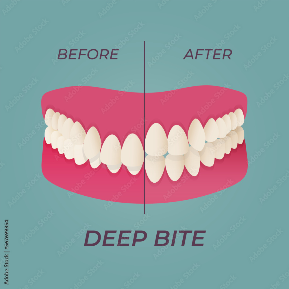 Vector de Stock Medical dental diagram illustration. Orthodontist human ...