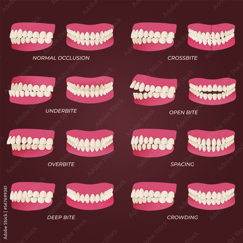 Medical dental diagram illustration. Orthodontist human tooth anatomy ...