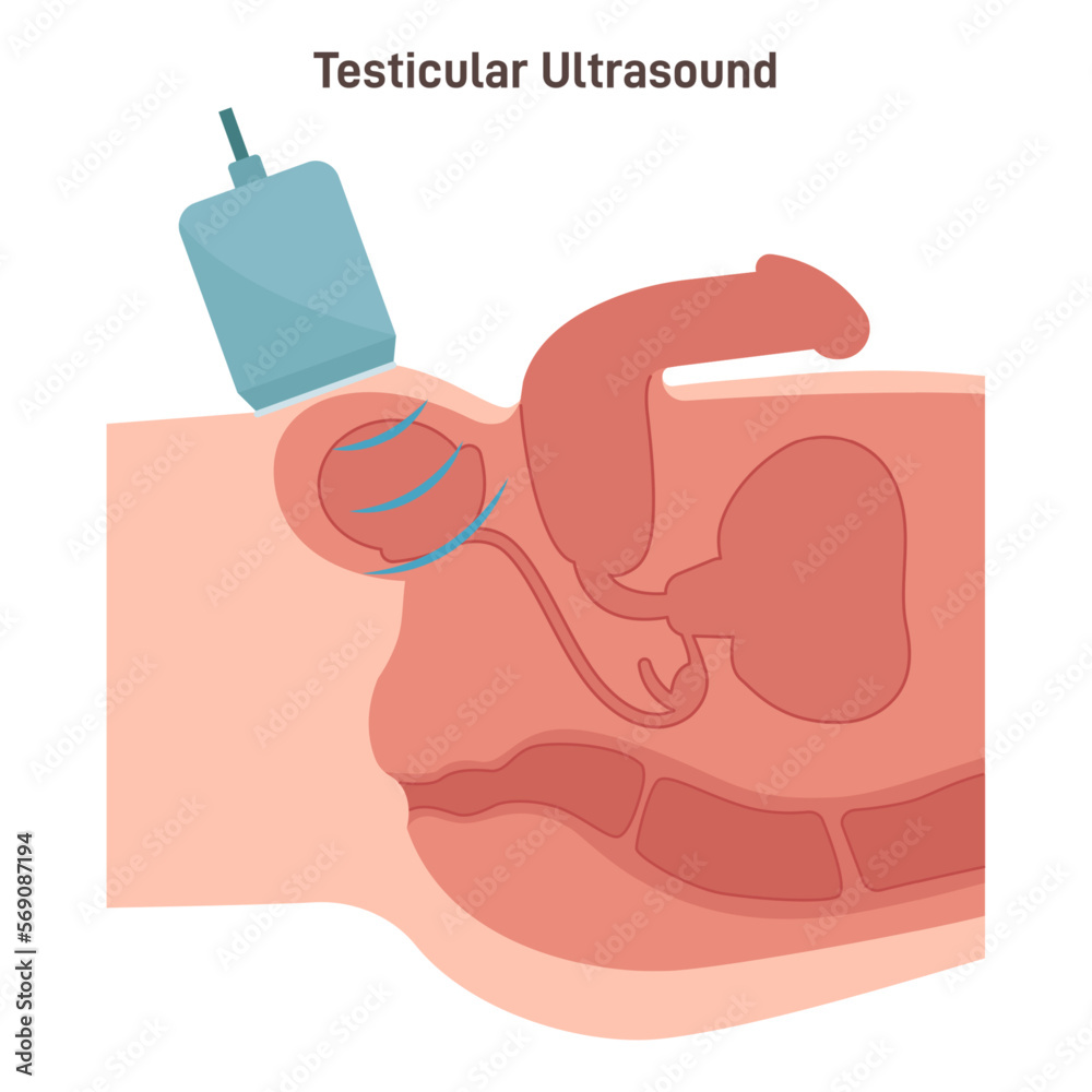 Testicular Ultrasound Male Reproductive System Diagnostic Testicular Anatomy Stock Vector