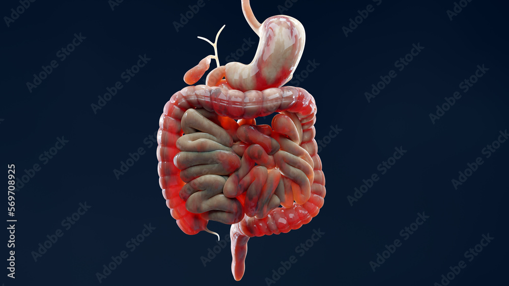 Stock-Illustration „man suffering from crohns disease, male anatomy ...