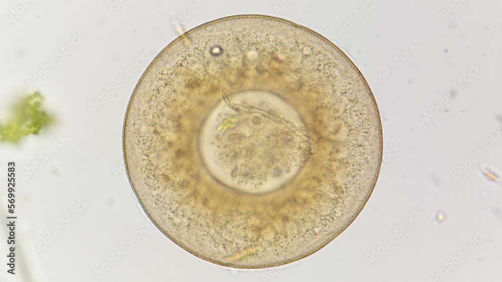 Testate amoeba, an amoeba with a smooth shell. Genus Galeripora. Lugol ...