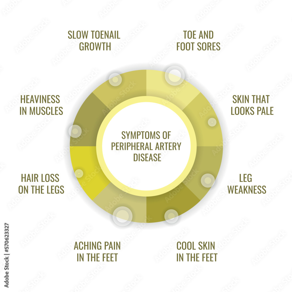 symptoms of Peripheral artery disease. Vector illustration for medical ...