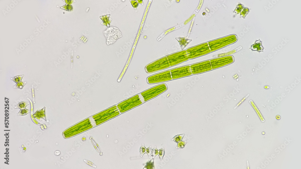 Foto de Stock Freshwater green algae called Penium sp (green long algae ...