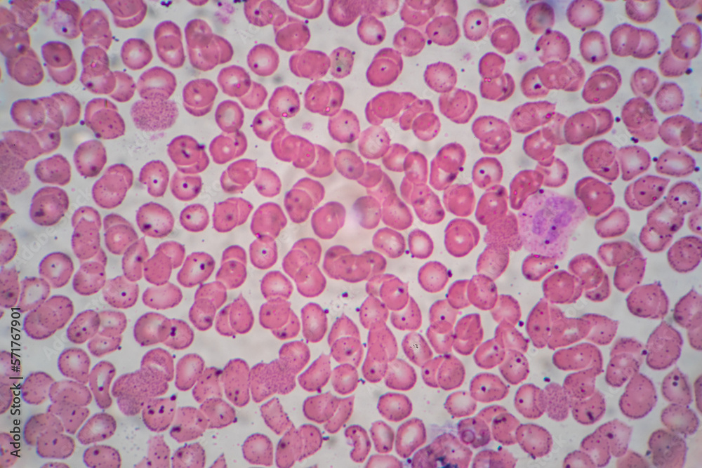 Human blood cells, Blood group and white blood cell study under ...