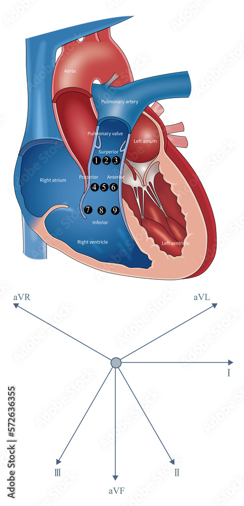 Ilustrace The figure shows the nine zones of the right ventricular ...