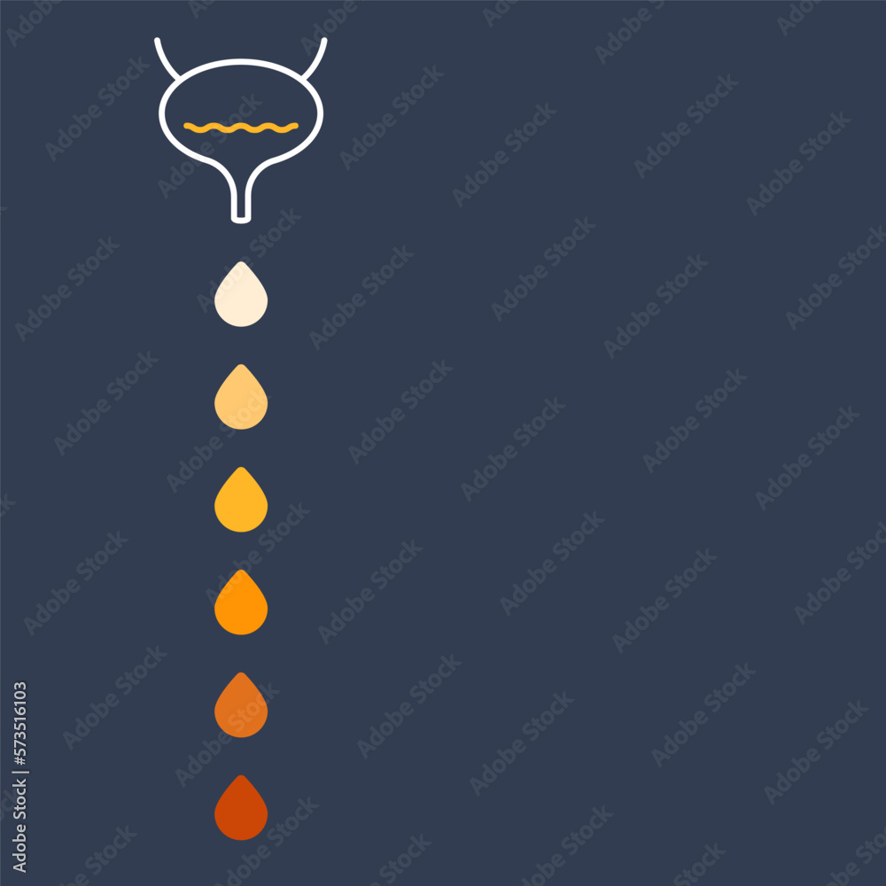 Urine color chart diagram. Bladder with urine drops showing different ...