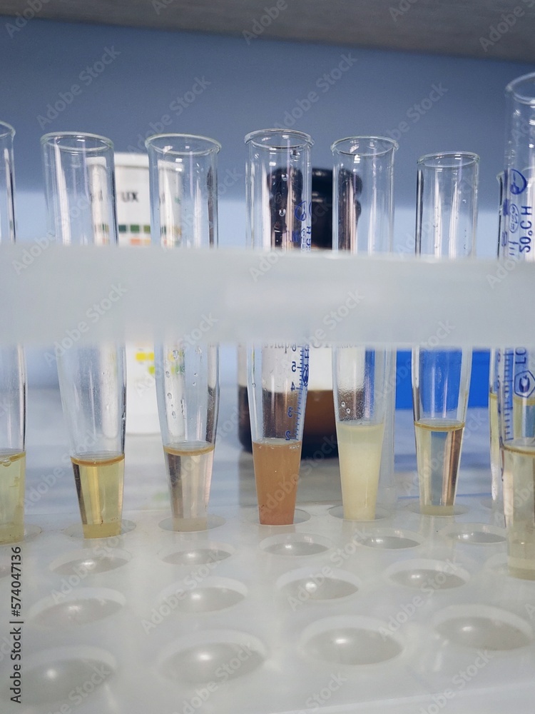Clinical examination of urine. Qualitative reaction to the protein ...