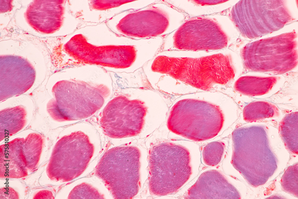 Adipose tissue human, Soft palate human, Bone human and Striated ...