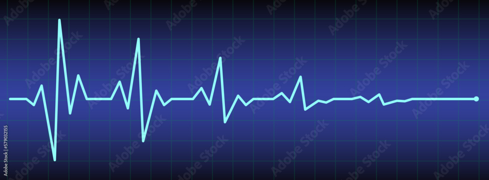 ecg, ekg monitor with cardio diagnosis illustration. Heart rhythm line ...