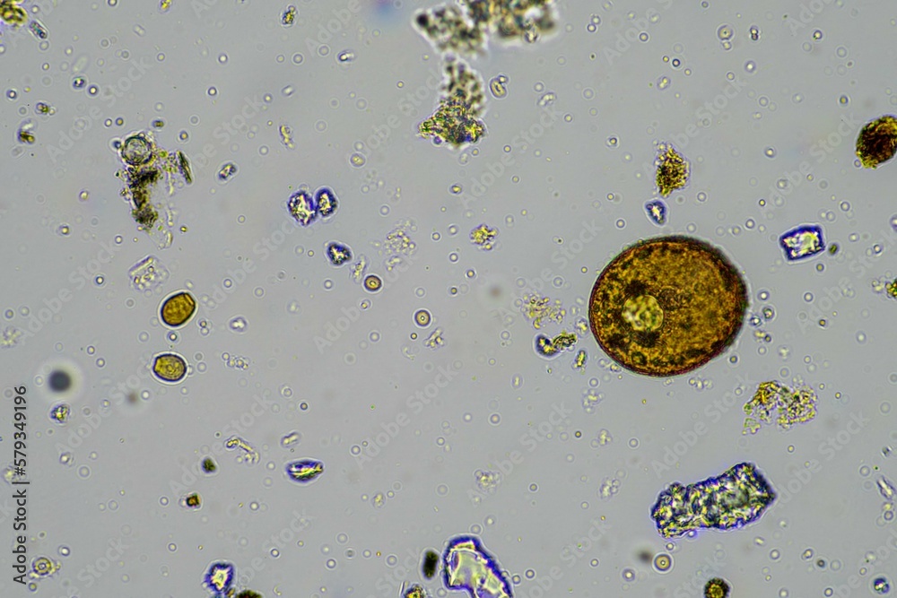soil microorganisms including nematode, microarthropods, micro ...