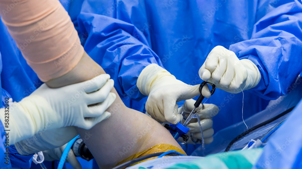 Team of doctor did arthroscopic orthopedic shoulder surgery inside ...