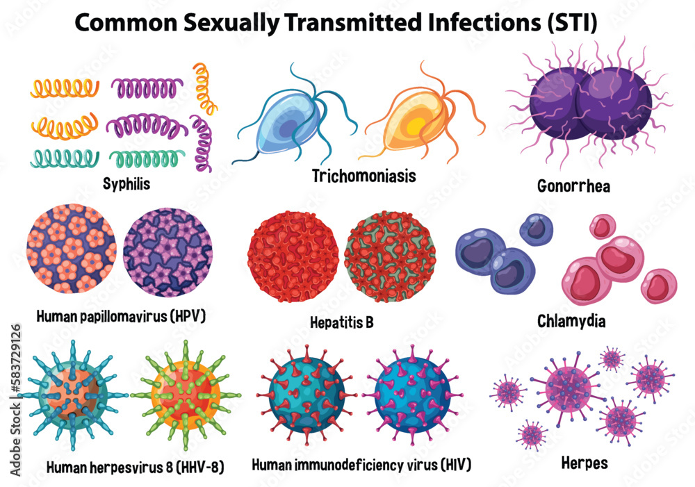 Common Sexually Transmitted Infections (STI) Stock Vector | Adobe Stock