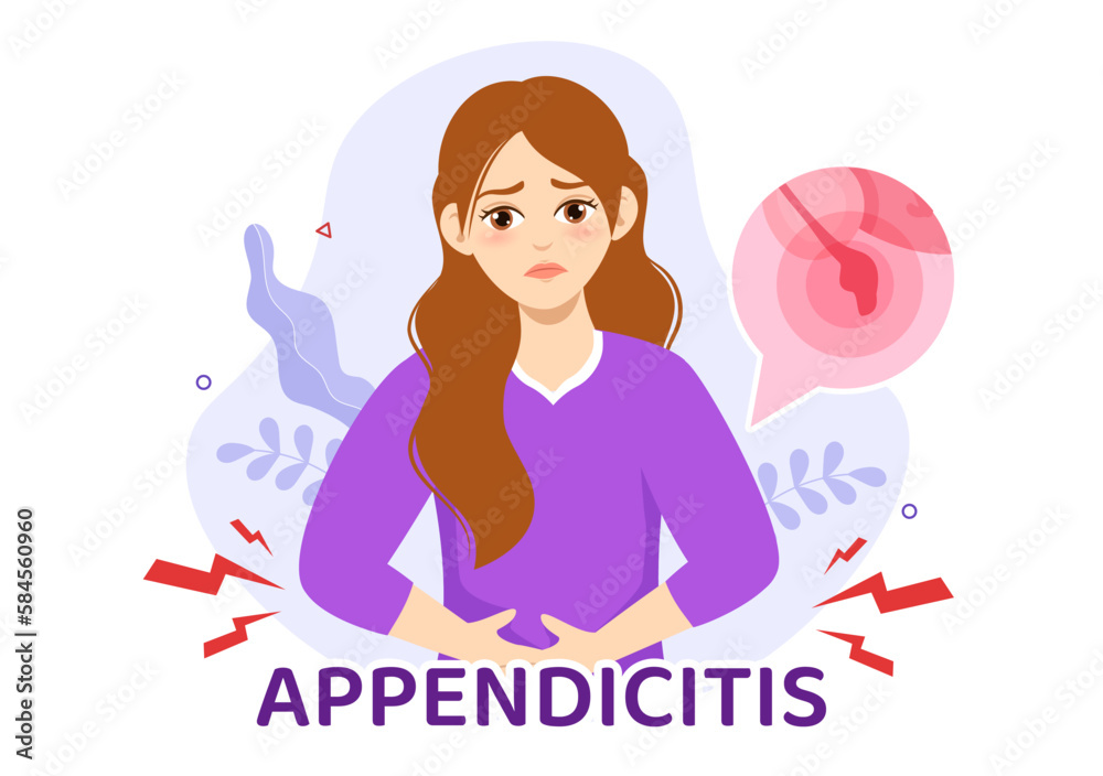 Appendicitis Illustration with Inflammation of the Appendix and Stomach ...