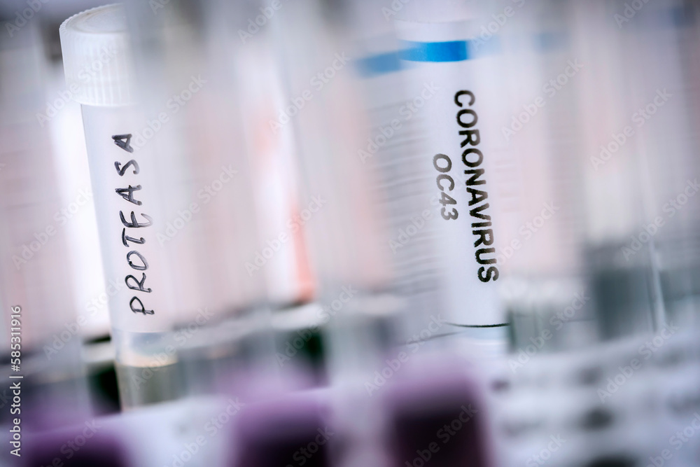 Several vials with soluble protease proteins for activation of the ...