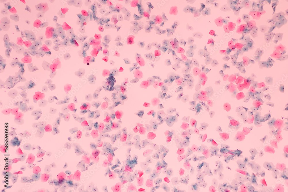View in microscopic of normal human cervix cells.Squamous epithelial ...