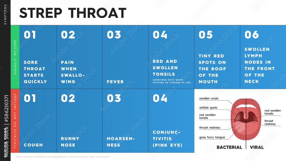 Vector infographic with strep throat symptoms. Some of them are: sore throat, fever, pain when ...