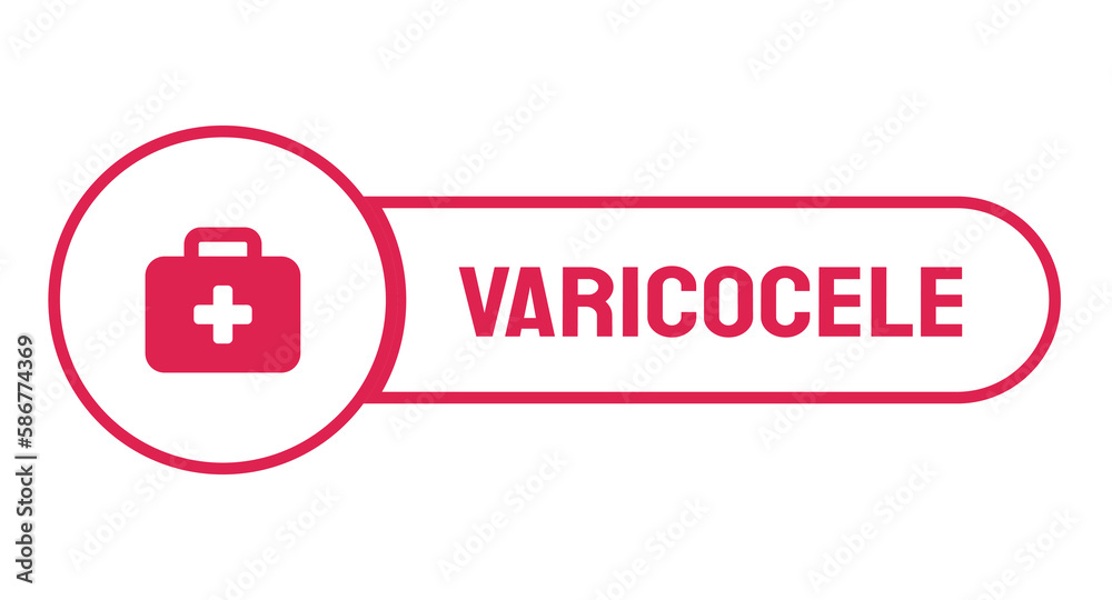 Varicocele: Enlargement of veins in the scrotum. Stock Vector | Adobe Stock
