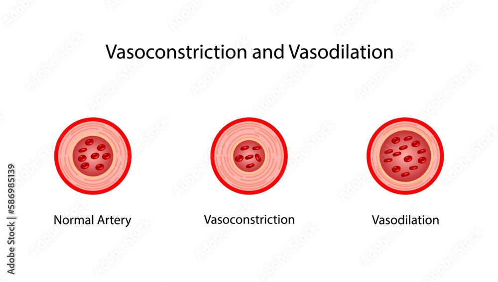 Arterial vasoconstriction and vasodilation. Cross section of arteries ...