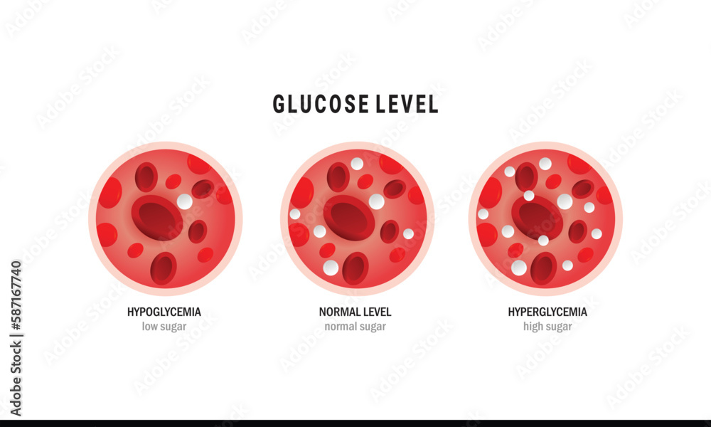 Glucose blood level sugar test. Diabetes insulin hypoglycemia or ...